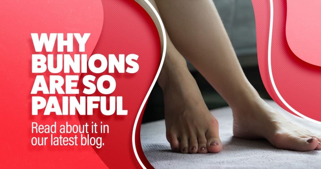 Why Bunions are So Painful - Evolution Research Group